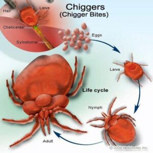 DIY Chigger Bite Relief - Grit